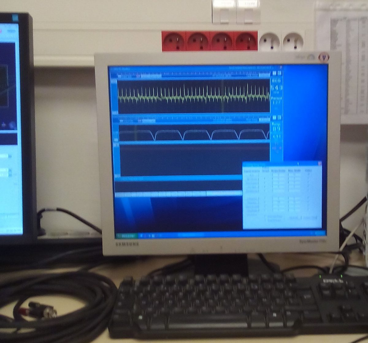 Physiological Monitoring - Center for Magnetic Resonance in Biology and ...