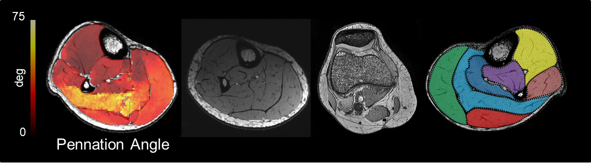 Musculoskeletal System - Center for Magnetic Resonance in Biology and ...